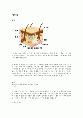 여드름에 정의와 예방-1페이지