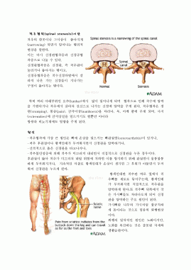 정형외과 케이스, 척추협착증 간호사례, 통증완화 방법, 낙상교육안-1페이지