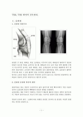 정형외과 고관절,슬관절 치환술 간호-1페이지