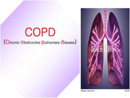 COPD(만성 폐쇄성 폐질환) -1페이지