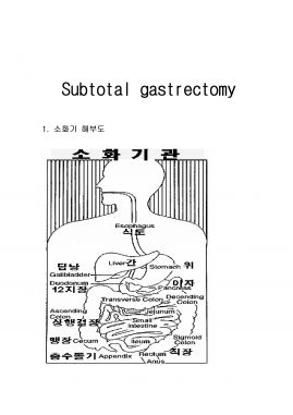 subtotal gastrectomy-1페이지