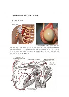 shouler op(rotator cuff tear, SLAP, bankart lesion)-1페이지