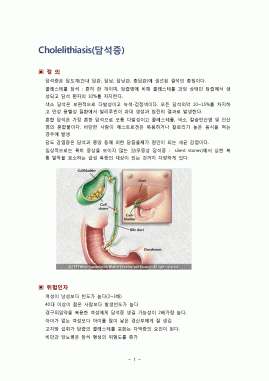 Cholelithiasis(담석증)-1페이지