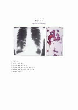 종양면역 (Tumor Immunology)-1페이지