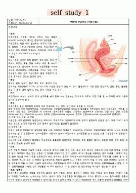 <간호학과> 여성실습 레포트 셀프스터디 -1페이지