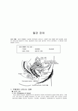 월경장애에 대하여-1페이지