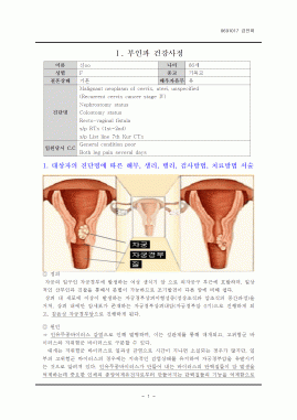 산부인과 실습 자궁암 case study -1페이지