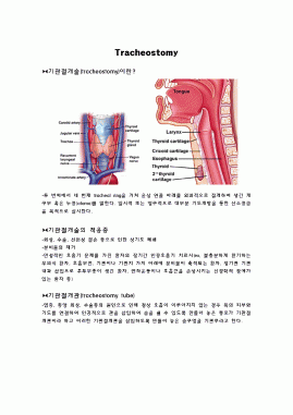 [논문] Tracheostomy-1페이지