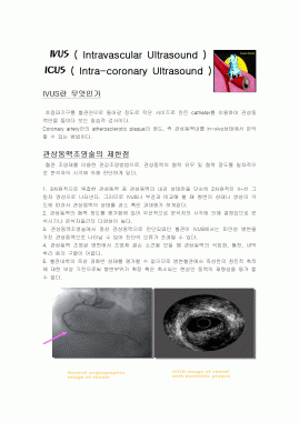 IVUS ( Intravascular Ultrasound )-1페이지