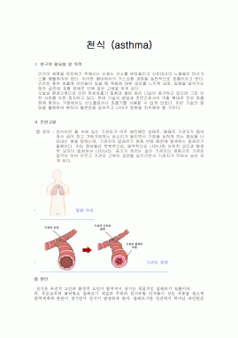 천식 케이스 스터디-1페이지