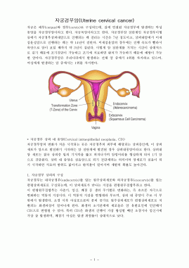 자궁경부암 가다실, 써바릭스, 백신, 유두종 바이러스-1페이지