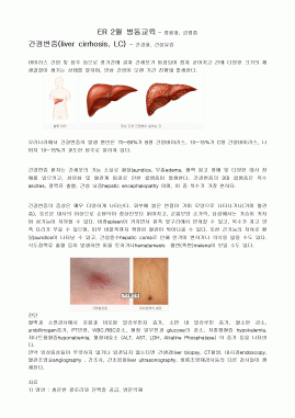 간경변증에대해서-1페이지