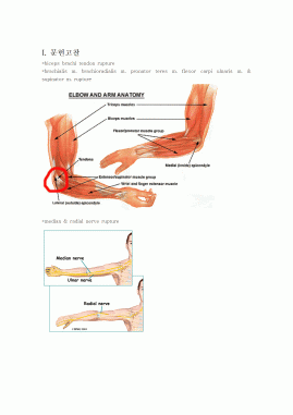 흉부외과 케이스) artery rupture 봉합술 (neurorrhaphy, myorrhaphy, tenorrhaphy), 수술 간호 -1페이지