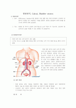 방광결석 문헌고찰-1페이지