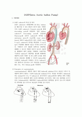 IABP(Intra Aortic ballon Pump) -1페이지