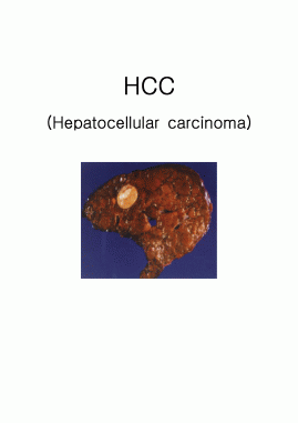 HCC (Hepatocellular carcinoma) 간세포암 케이스-1페이지