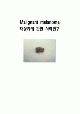 Malignant melanoma 케이스 - 자료 및 방법, 문헌고찰, 간호과정, 결론 및 제언-1페이지