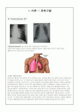 기흉 케이스 간호학과-1페이지