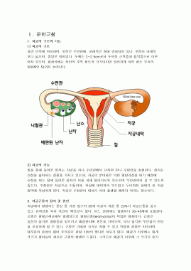 여성병동 자궁근종 케이스-1페이지