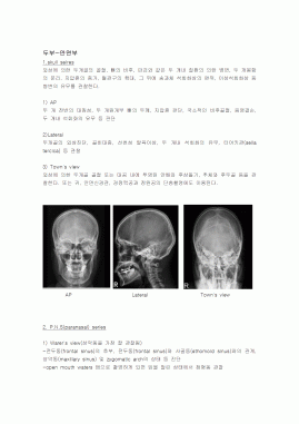 X-ray에 대해-1페이지