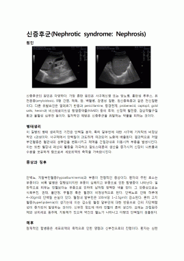 신증후군(Nephrotic syndrome Nephrosis)-1페이지