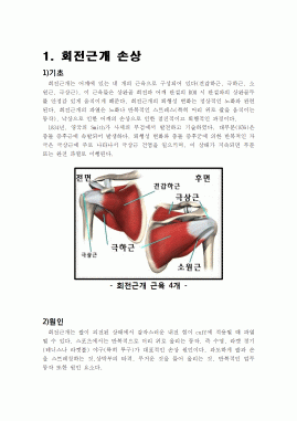 회전근개파열-case study-1페이지