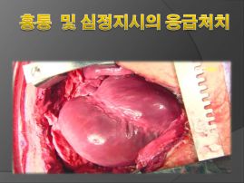 흉통 및 심정지시의 응급처치-1페이지