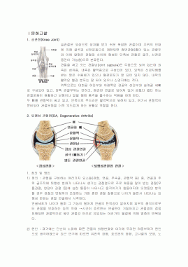 OS케이스-TKR-1페이지