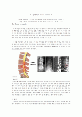 spinal stenosis 정형외과 case study-1페이지