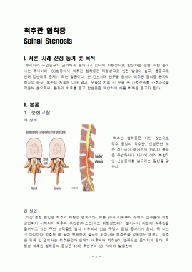 척추관 협착증 케이스스터디입니다. 문헌고찰과 간호과정으로 이루어집니다. 간호진단은 3개 내려보았습니다. -1페이지