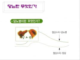 당뇨병에 대한 내용-1페이지