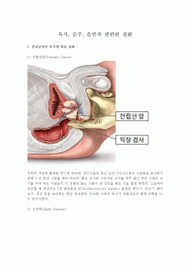 육식, 음주, 흡연과 관련된 질환-1페이지