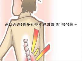 골다공증 완성-1페이지