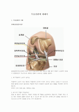 무릎질환에 대해-1페이지