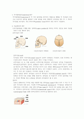 두개골 절제술(Craniectomy) - 수술체위와 해부, 수술 방법, 수술 전후 간호, 합병증-1페이지