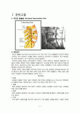 OS 추간판탈출증 척추분리증(Herniated Intervertebral Disc) 케이스 스터디-1페이지