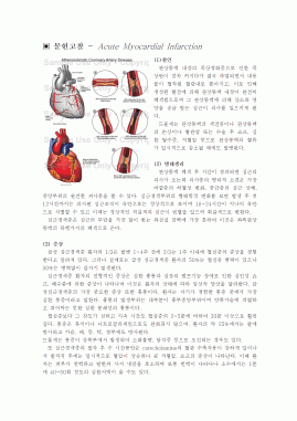 [성인간호학] 심맥관계 중환자실 case (Acute Myocardial Infarction)-1페이지