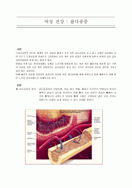 여성 건강 - 골다공증 -1페이지