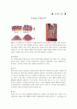 폐암 케이스 스터디 (Lung Cancer Case Study)-1페이지