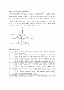 Electrocardiogram(ECG, EKG, 심전도)-1페이지