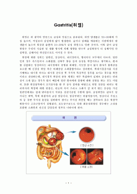 Gastritis(위염)-1페이지