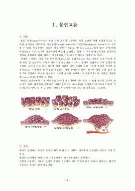 [성인]폐암 CASE (lung cancer CASE)-1페이지