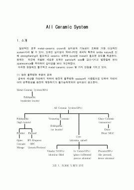 [치과재료학] 올세라믹의 종류 및 장단점-1페이지