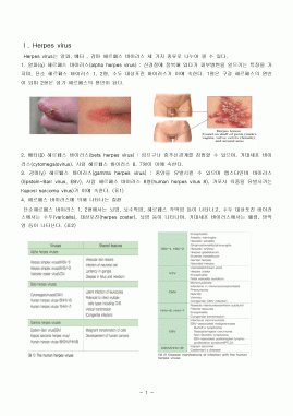 대상포진(Herpes zoster) Case study-1페이지