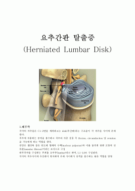 스포츠 선수의 요추간판 탈출증(Herniated Lumbar Disk) 해부학 및 손상,치료 ,재활-1페이지