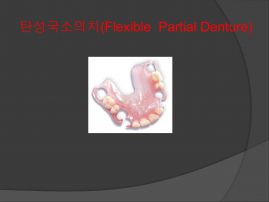 탄성국소의치(Flexible partial denture).ppt-1페이지