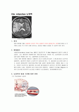 [신경외과] Cbr. infarction 뇌경색 급성뇌경색MRI-1페이지