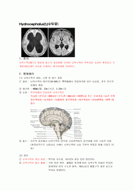 [신경외과] Hydrocephalus(뇌수두증)-1페이지