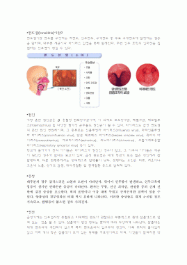 편도염(tonsillitis) 케이스-1페이지