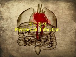 [해부생리학] 심근경색 Myocardial Infarction.PPT자료-1페이지